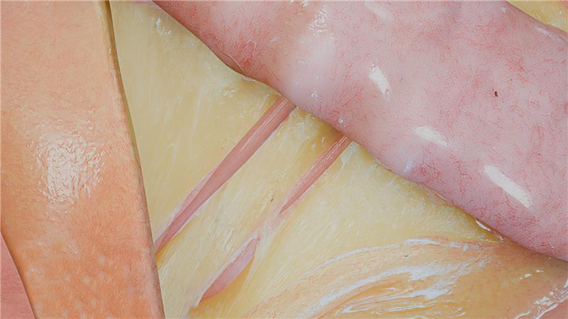 New LapAR Modules Target Key Surgical Skills | Halldale Group